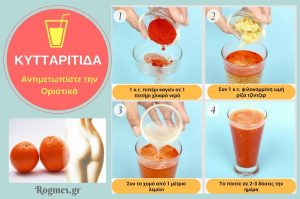 Μυστικά & Θεραπείες Για Να Αντιμετωπίσετε Οριστικά Την Κυτταρίτιδα