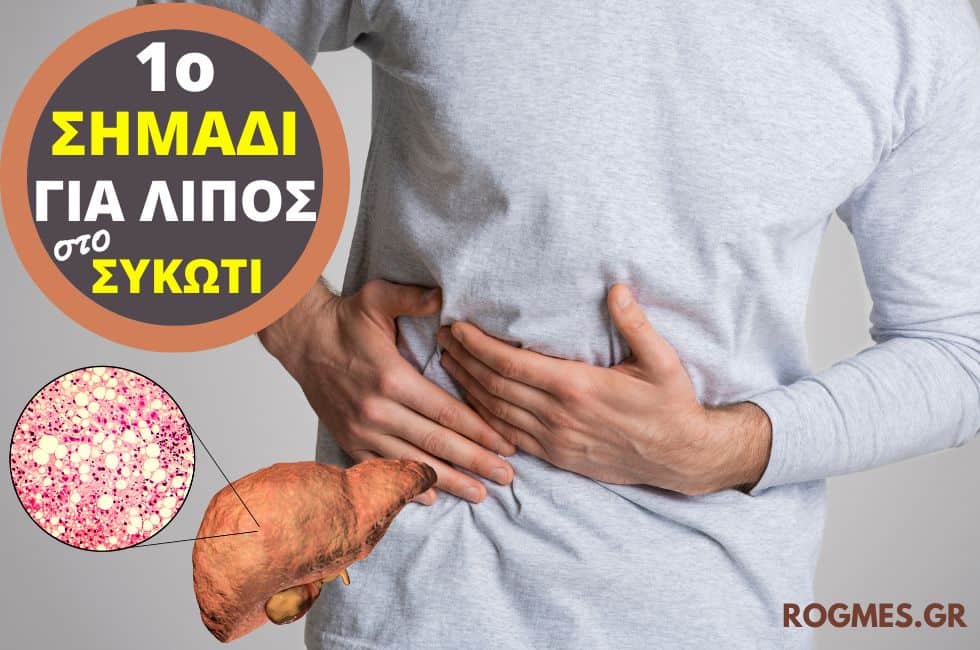 1ο Σημάδι Που Δείχνει Λίπος Στο Συκώτι - Τι Να Κάνετε